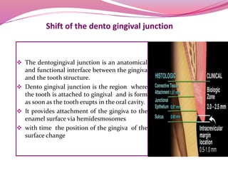 Dentinogingival junction | PPTX