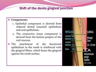 Dentinogingival junction | PPTX