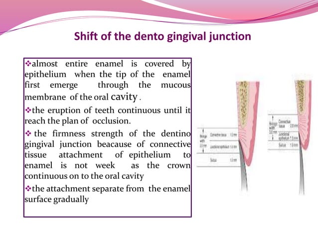 Dentinogingival junction | PPTX