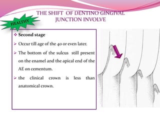 Dentinogingival junction | PPTX