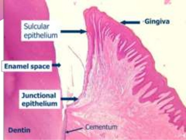 Dentinogingival junction