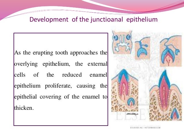 Dentinogingival junction