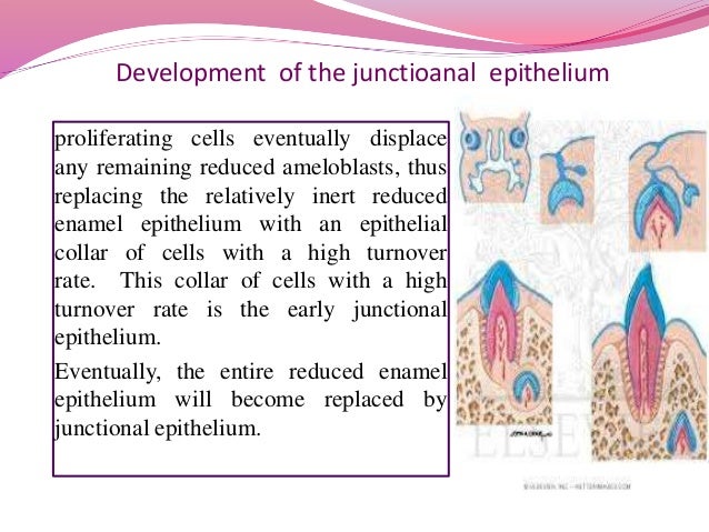 Dentinogingival junction