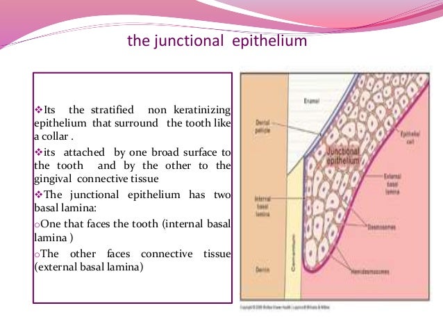 Dentinogingival junction