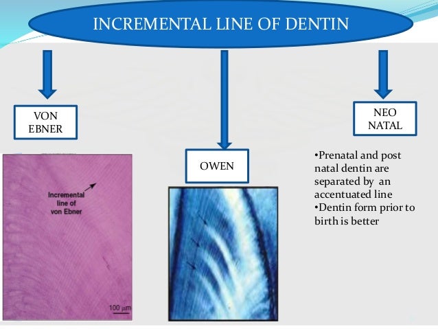 Incremental Lines Of Von Ebner Oral Histology Digital Lab: Dentin: