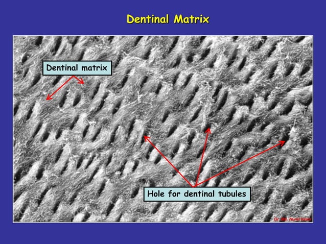 Dentin pulp complex | PPTX