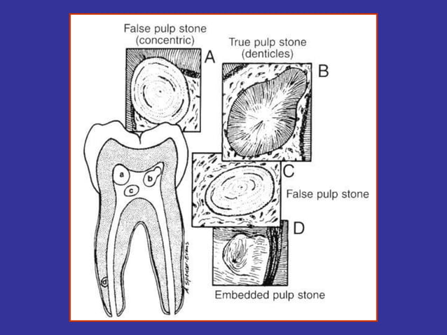 Dentin pulp complex | PPTX