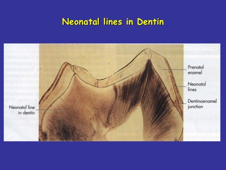 Dentin pulp complex