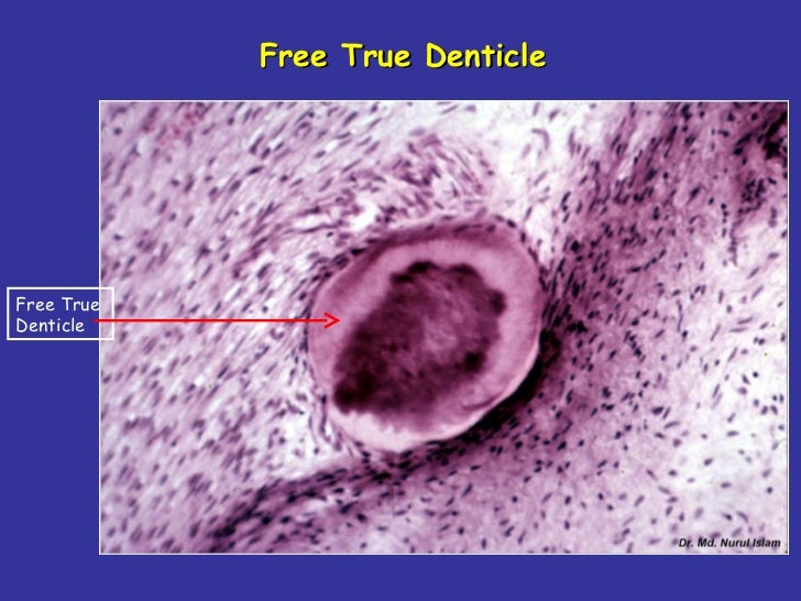 Dentin pulp complex