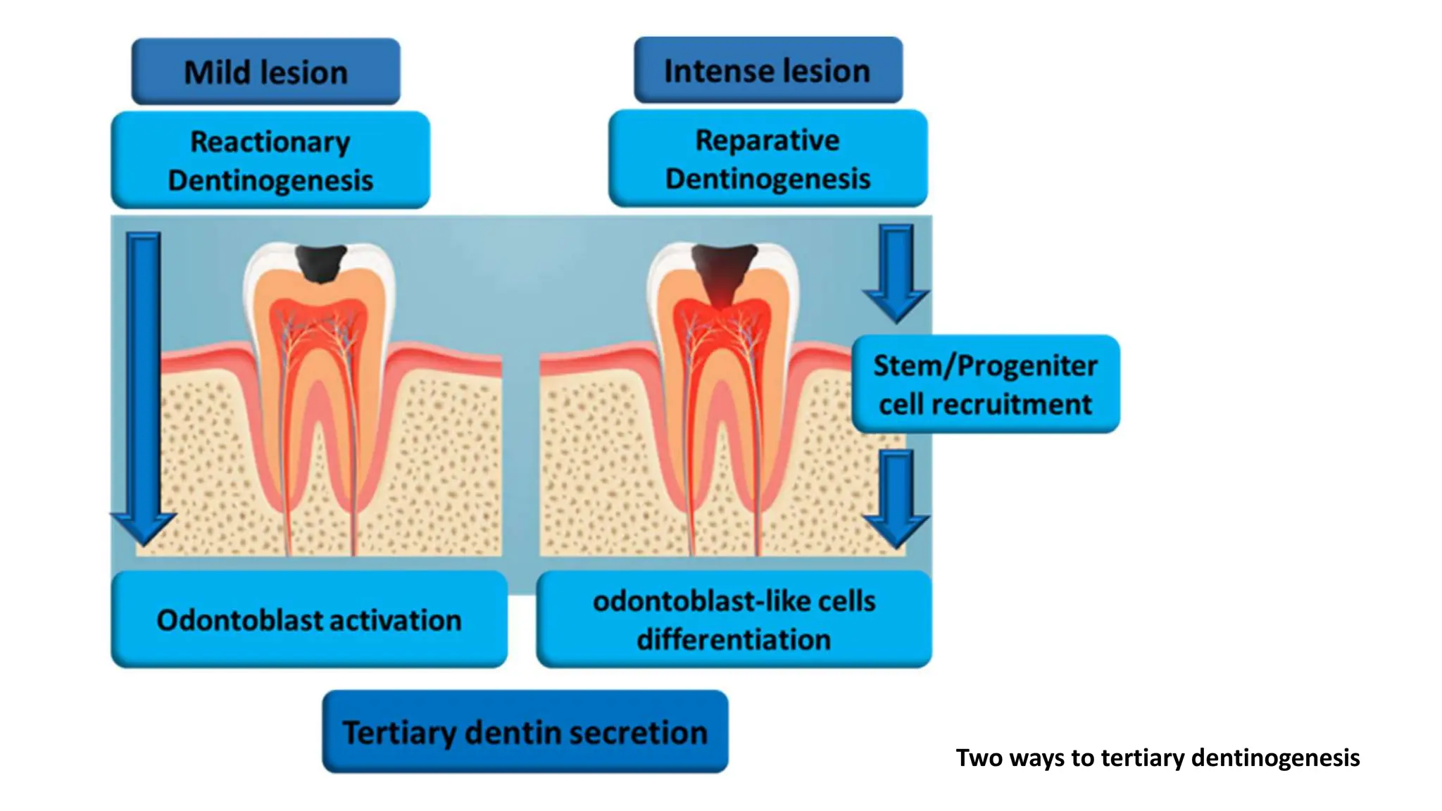 Dentin regeneration based on tooth tissue engineering: A review | PPTX