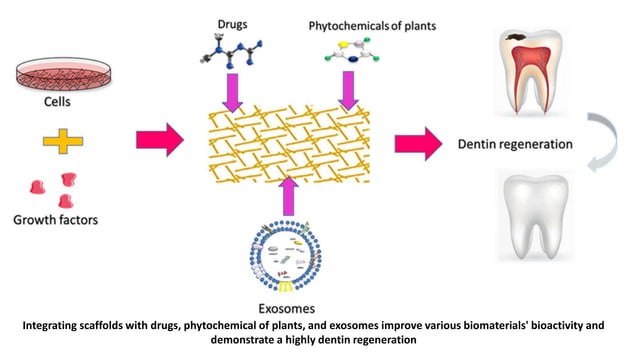 Dentin regeneration based on tooth tissue engineering: A review | PPTX