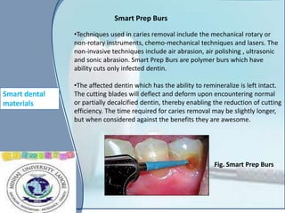 smart materials in dentistry | PPTX