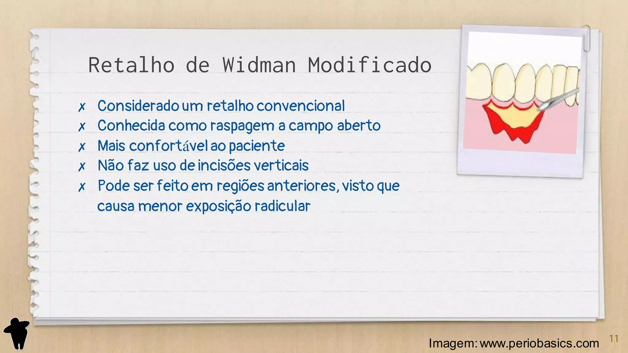 Resumo de Periodontia - Retalho de Widman, Widman Modificado, Kirkland ...