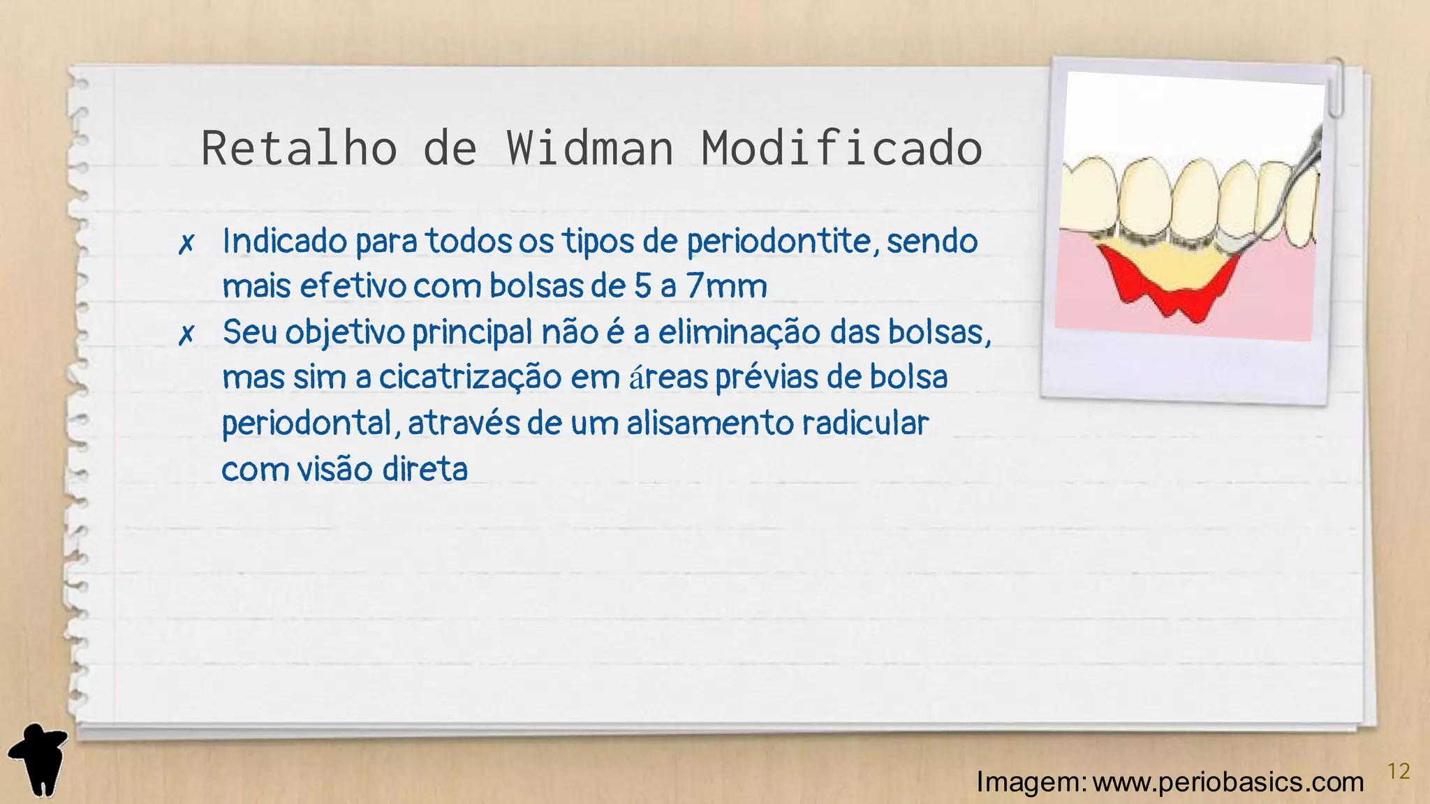 Resumo de Periodontia - Retalho de Widman, Widman Modificado, Kirkland ...