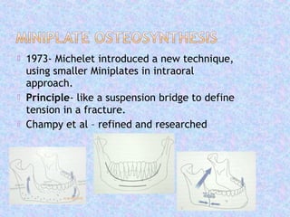 Dentist in pune.(BDS) MDS- OMFS - Dr. Amit T. Suryawanshi.. Mandibular ...