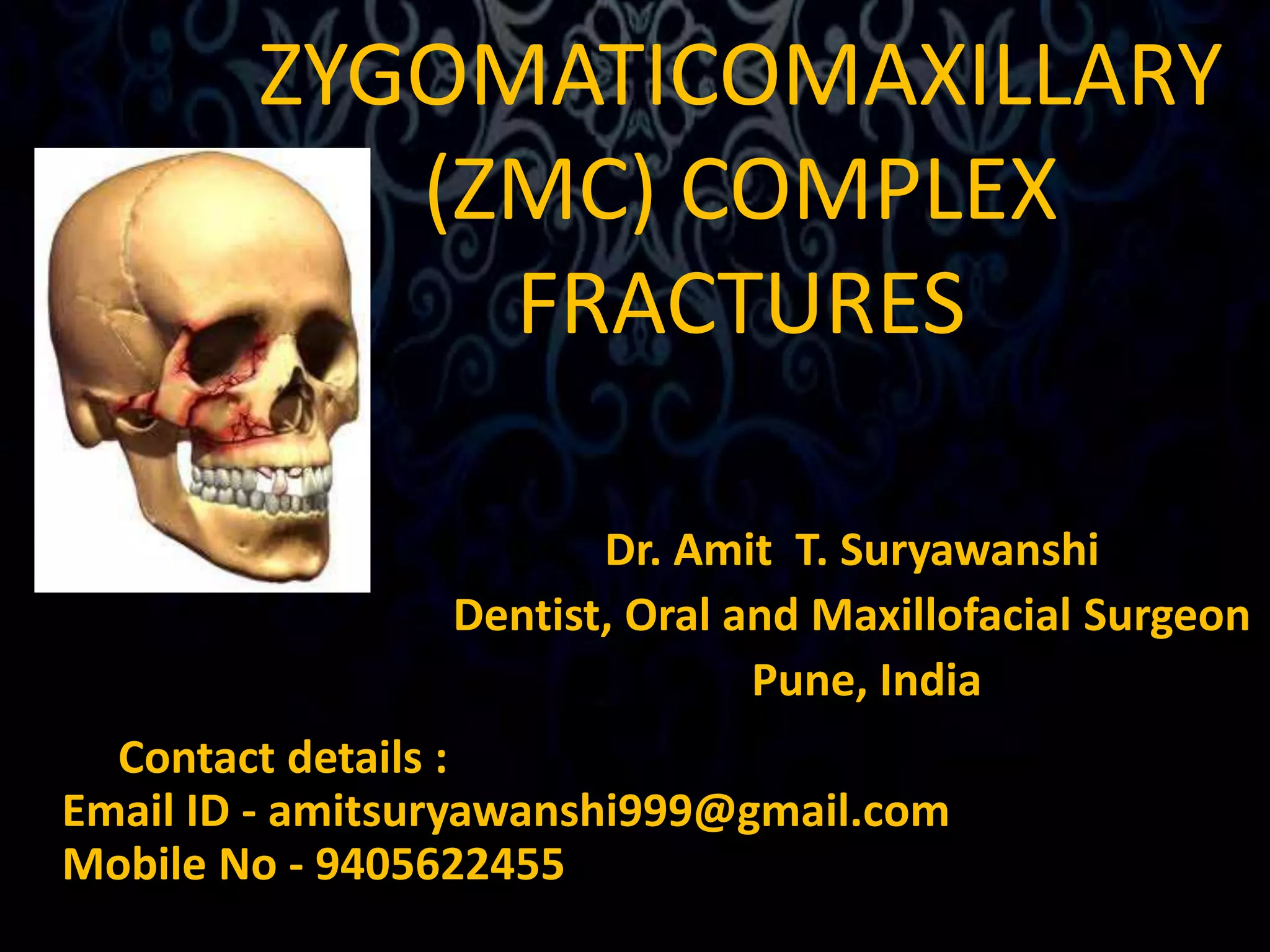 Dentist in pune.(BDS. MDS) - Dr. Amit T. Suryawanshi ...