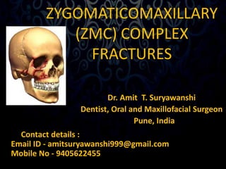 Dentist in pune.(BDS. MDS) - Dr. Amit T. Suryawanshi ...