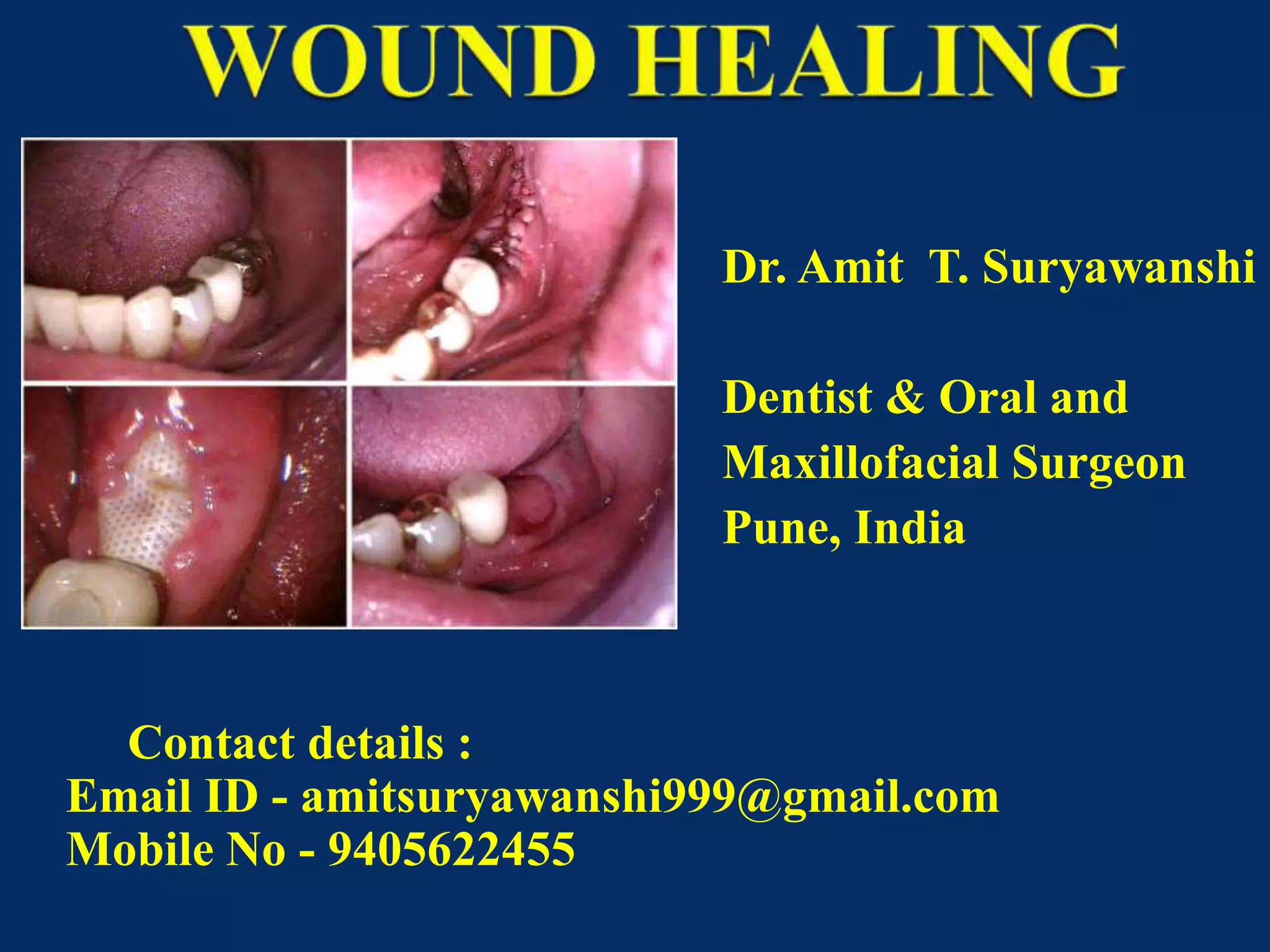 Dentist in pune.(BDS. MDS) - Dr. Amit T. Suryawanshi. Wound healing in Dentistry. | PPTX