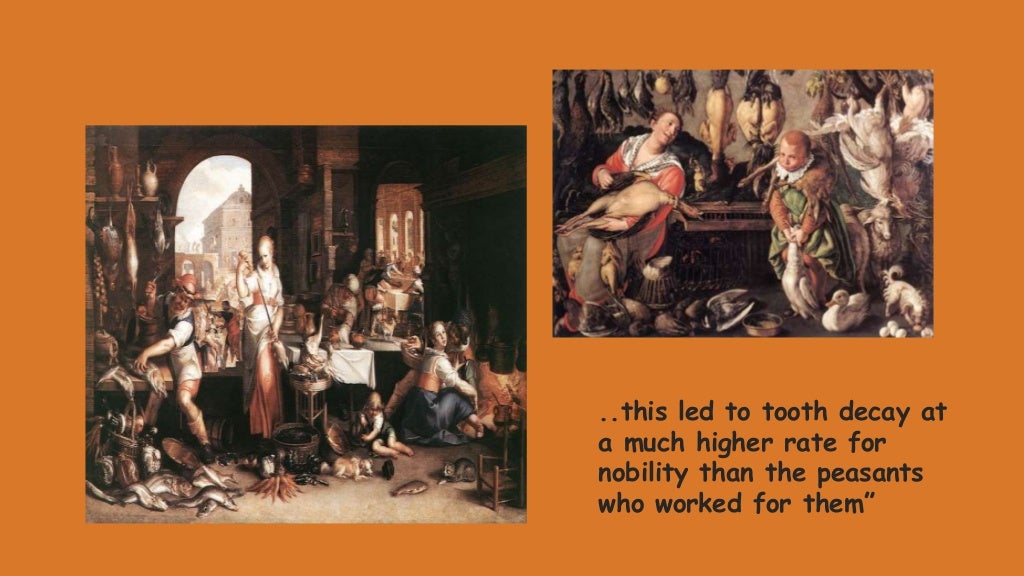 Dentistry in Renaissance Period