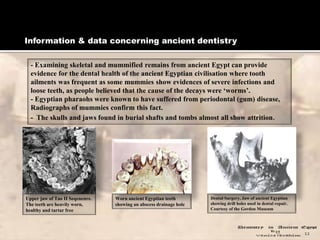 Dentistry v | PDF