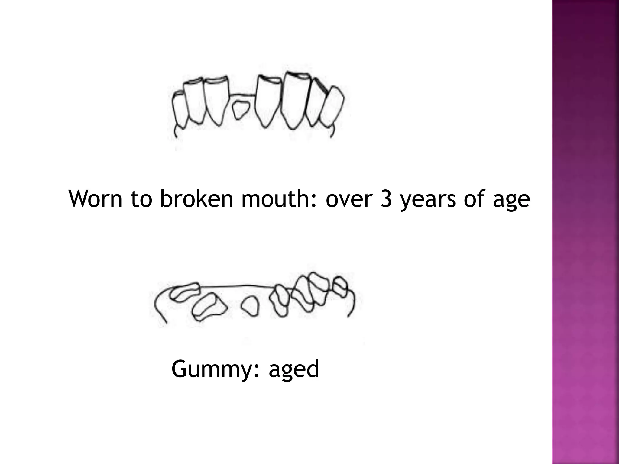 Dentition of sheep and goat | PPTX