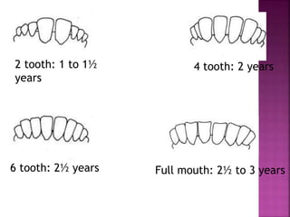 Sheep Teeth Diagram