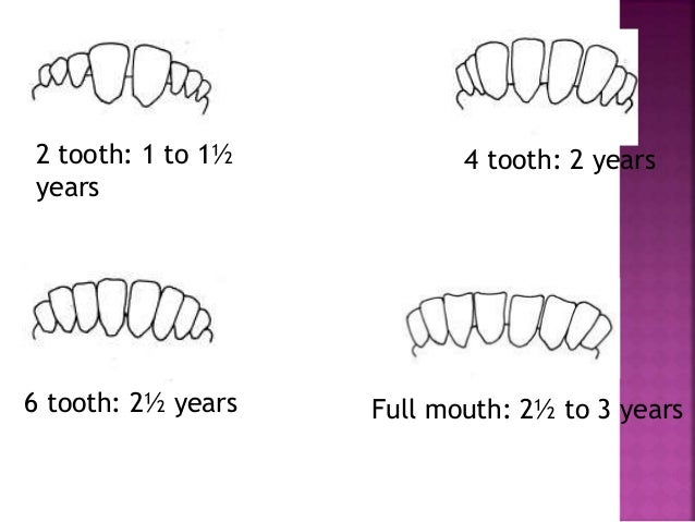 Dentition of sheep and goat
