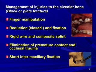Alveolar Bone Fracture