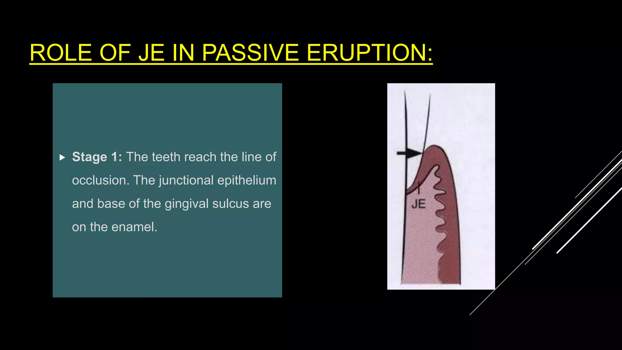 Dento gingival junction | PPTX