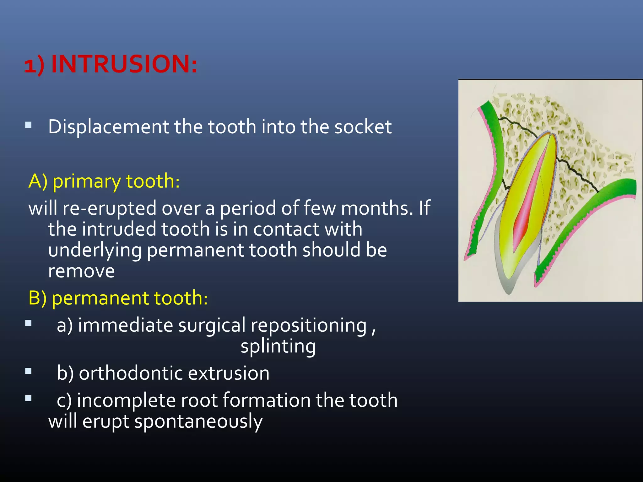 Dentoalveolar injuries ppt | PPT
