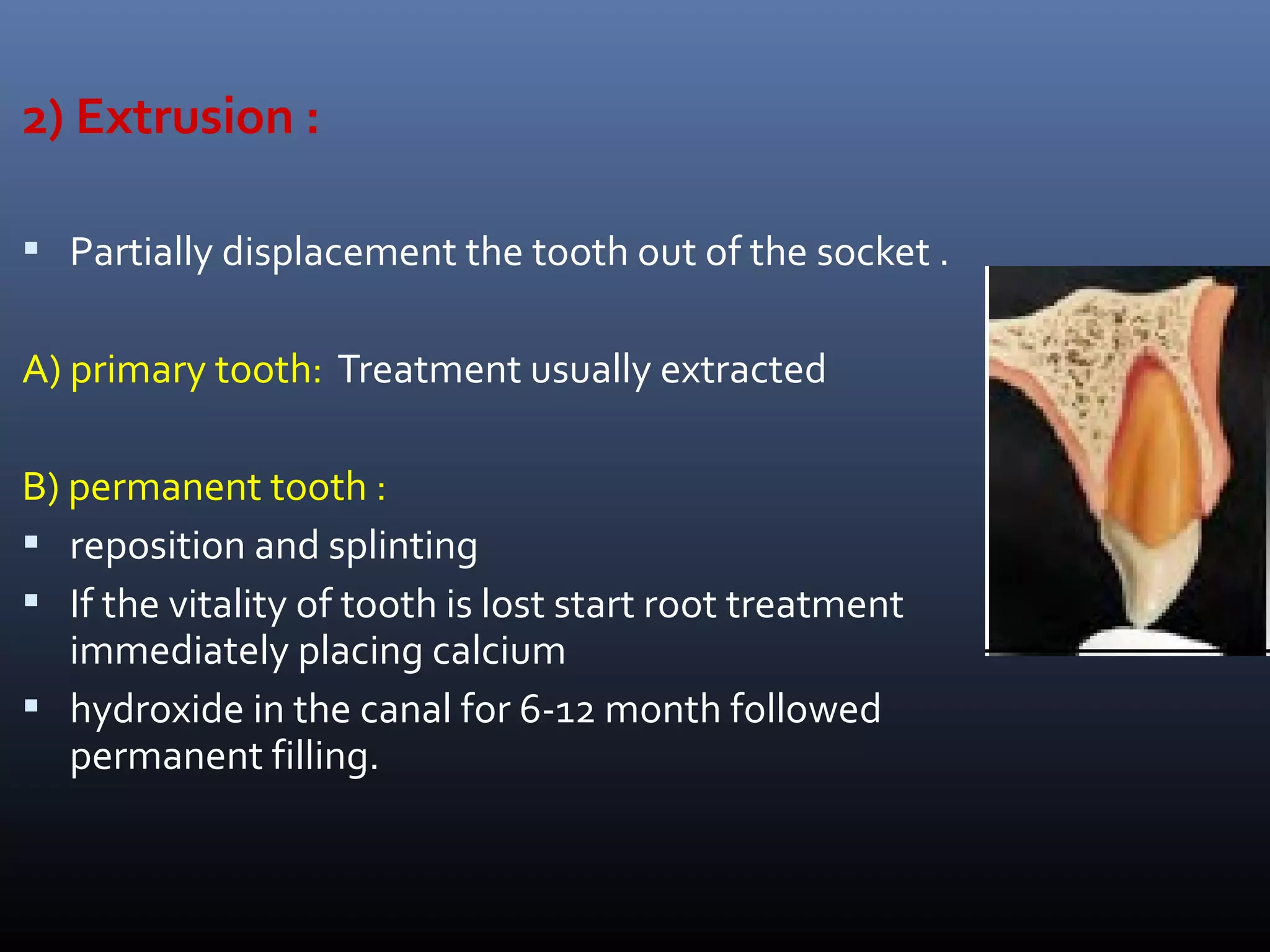 Dentoalveolar injuries ppt | PPT