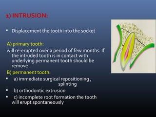 Dentoalveolar injuries ppt | PPT