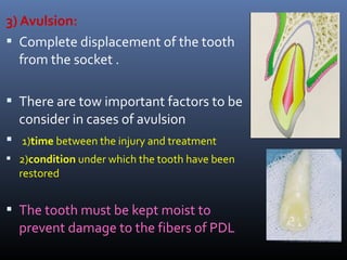 Dentoalveolar injuries ppt | PPT | Dental Health | Diseases and Conditions