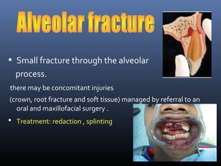 Dentoalveolar injuries ppt | PPT