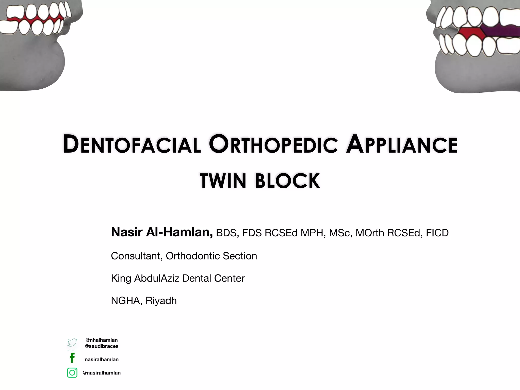 Dentofacial Orthopedic Appliance - Twin Block | PDF