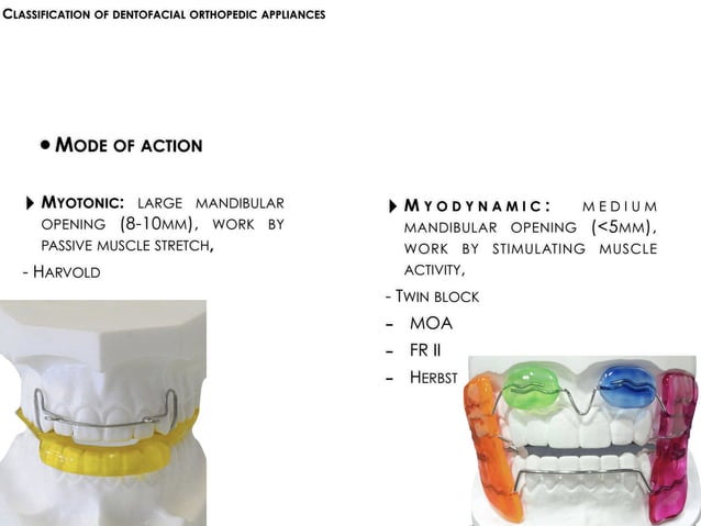 Dentofacial Orthopedic Appliance - Twin Block | PDF