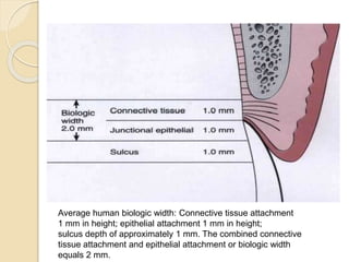 Dento gingival unit | PPTX