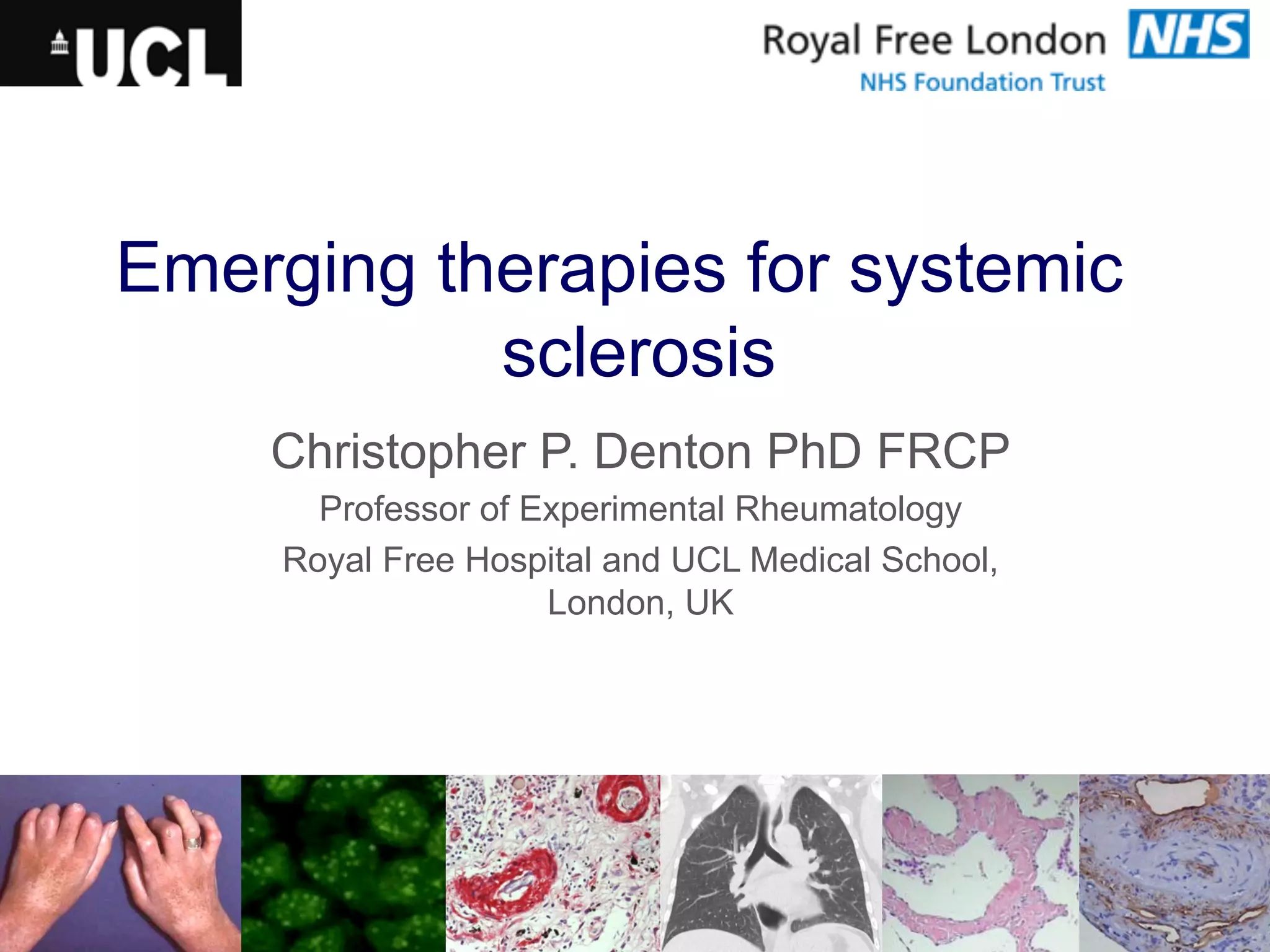 Professor Chris Denton - Emerging therapies | PDF