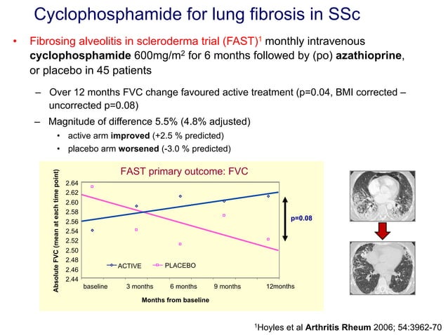 Professor Chris Denton - Emerging therapies | PDF