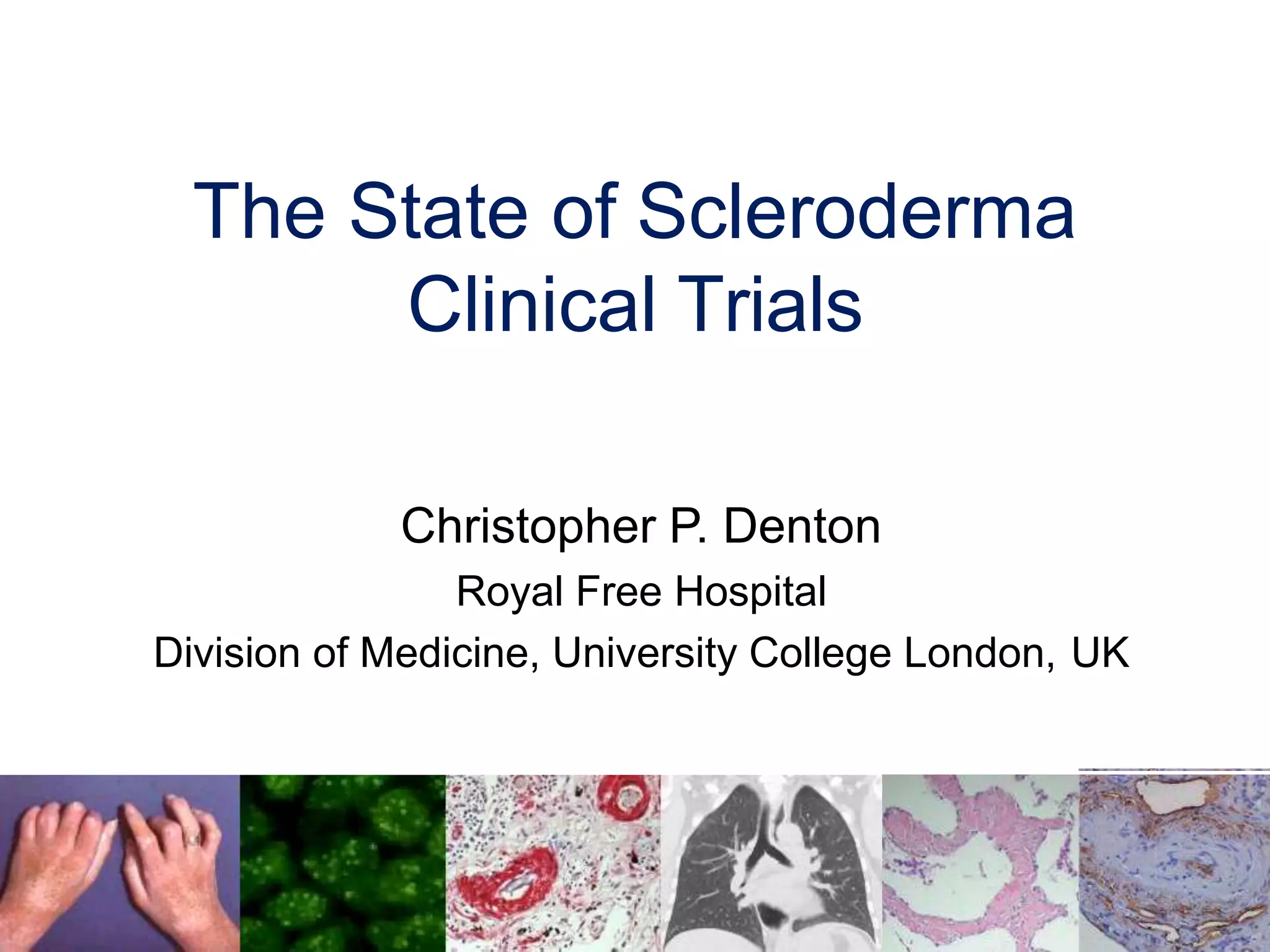 The State of Scleroderma Clinical Trials | PPTX