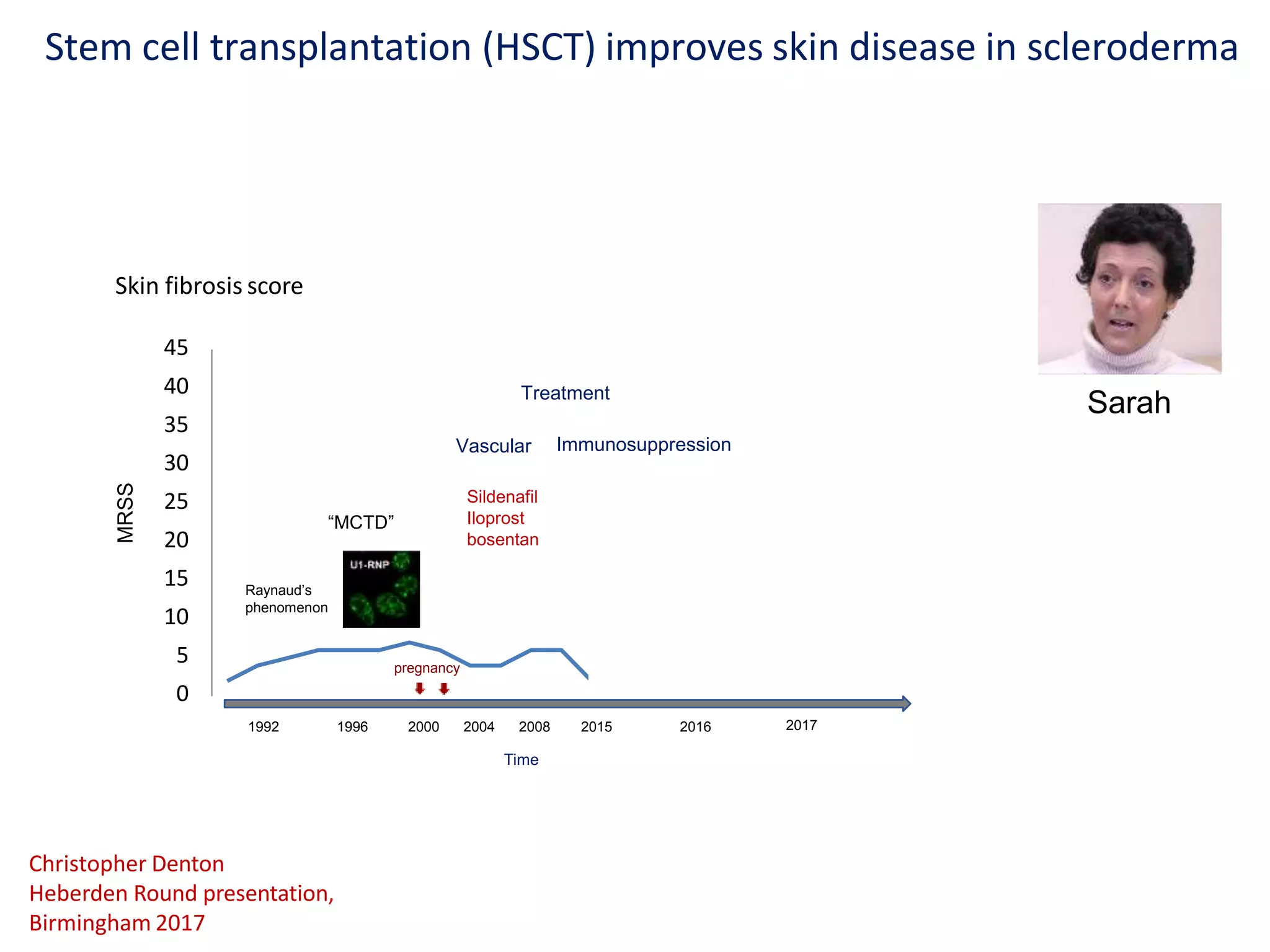 The State of Scleroderma Clinical Trials | PPTX