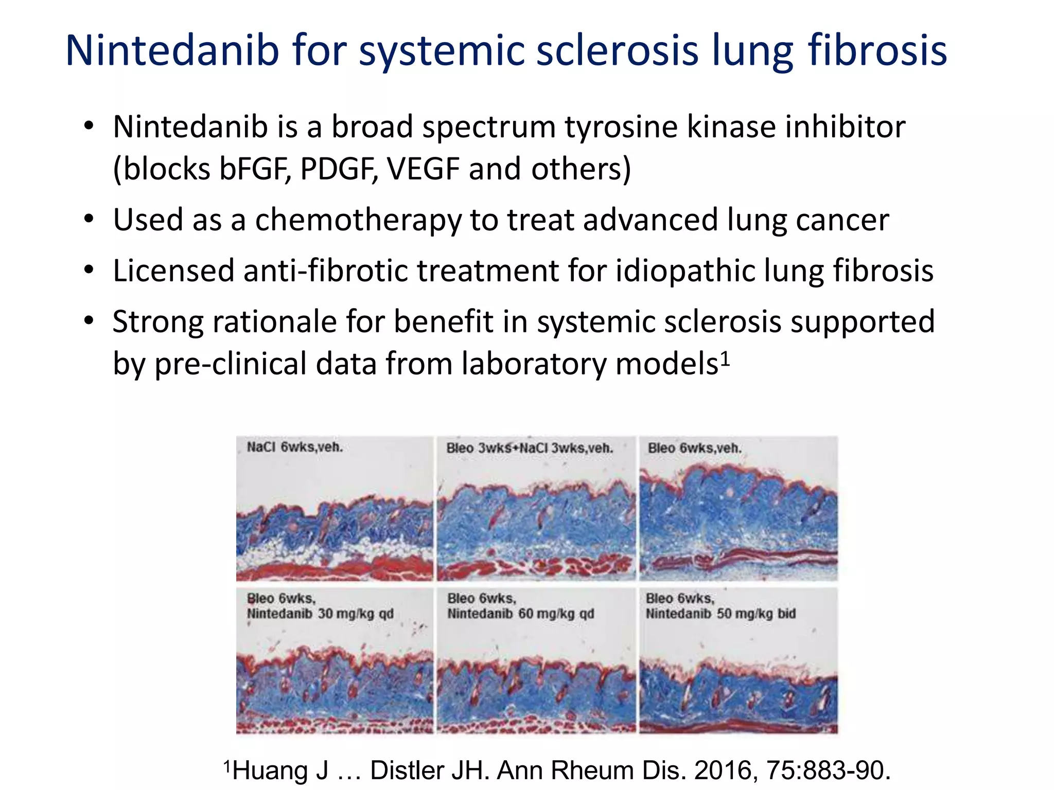 The State of Scleroderma Clinical Trials | PPTX