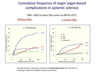 The State of Scleroderma Clinical Trials | PPTX
