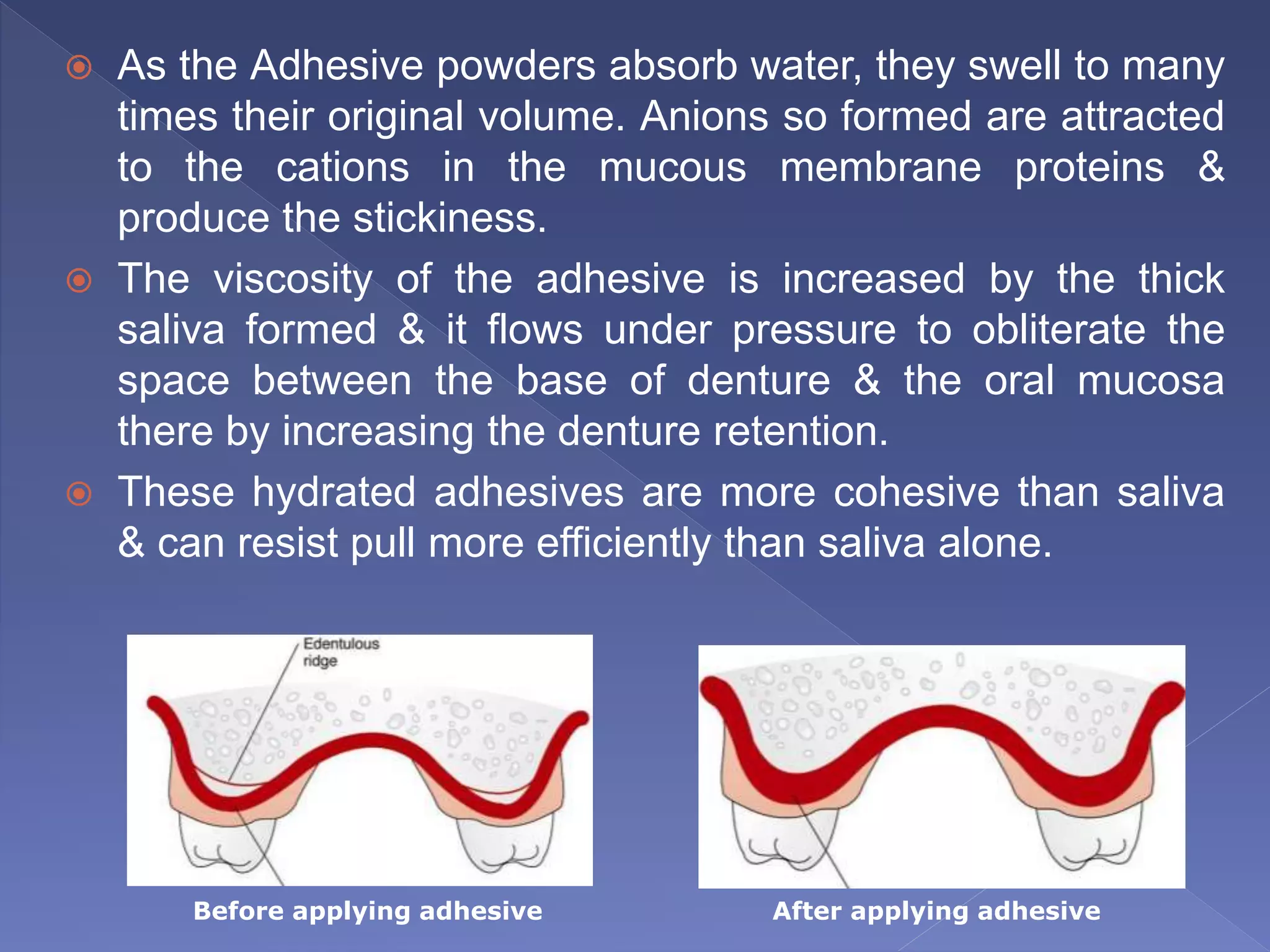 Denture adhesives and cleansers | PPTX