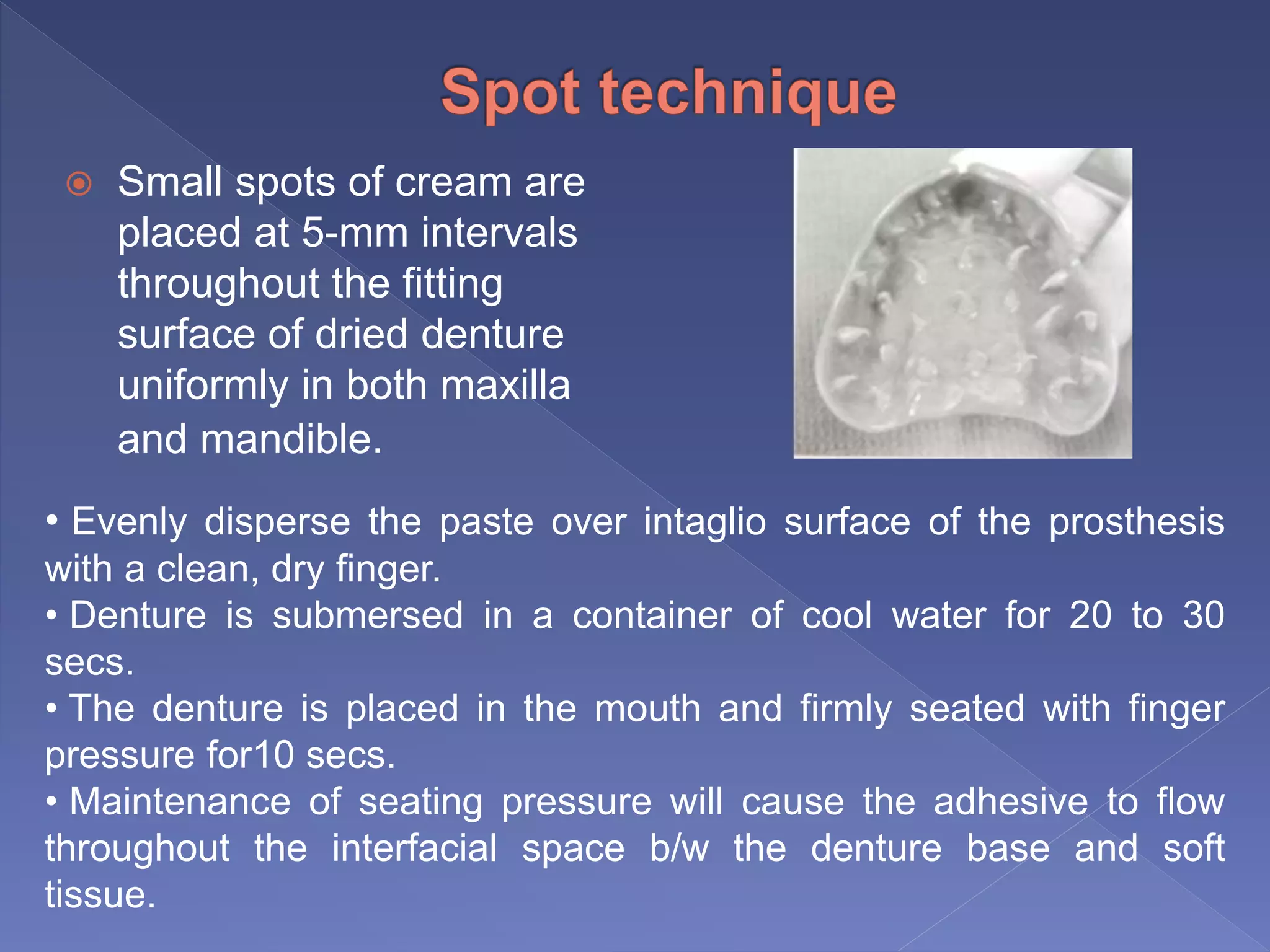 Denture adhesives and cleansers | PPTX