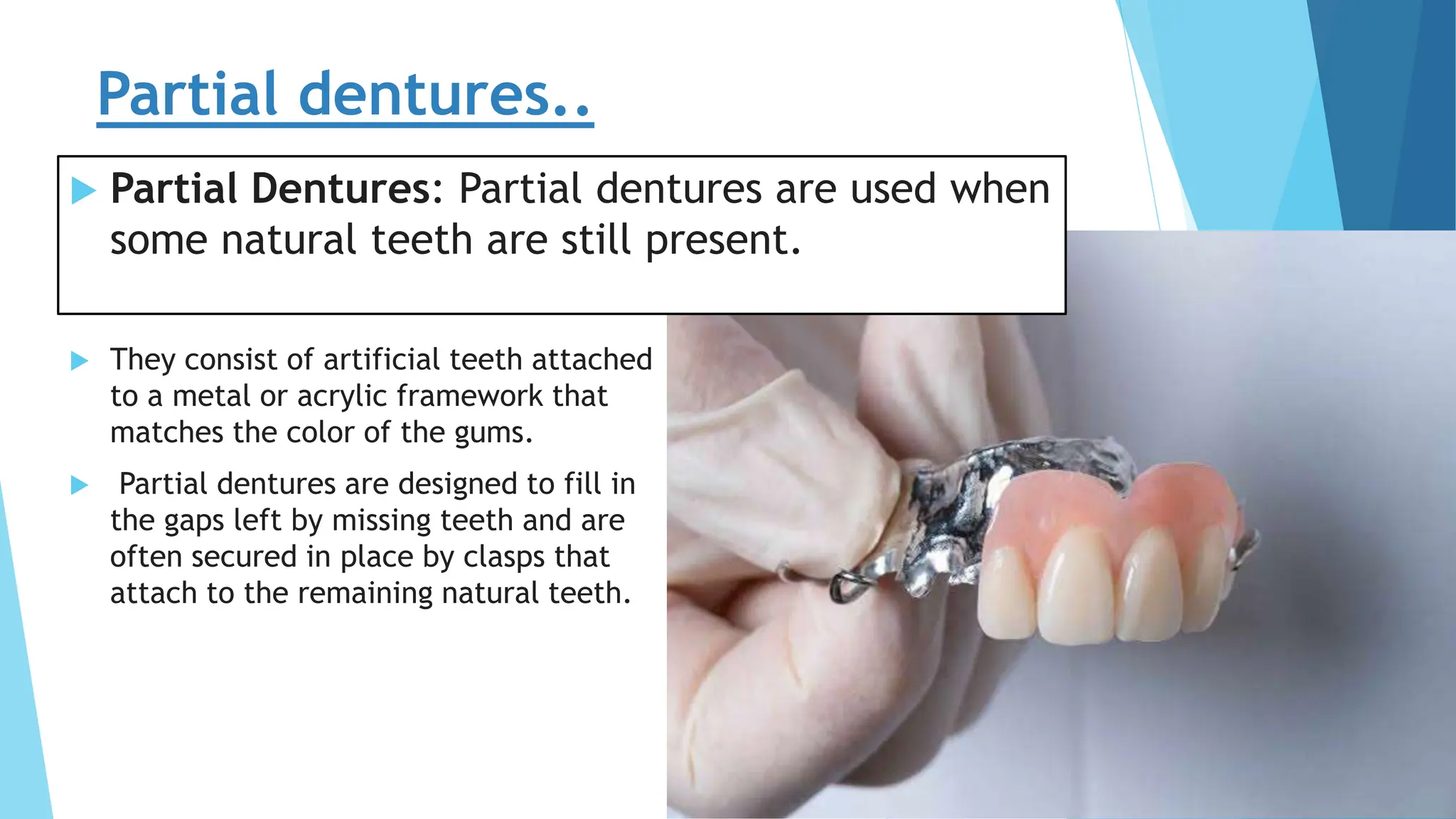 Denture and types...pptx