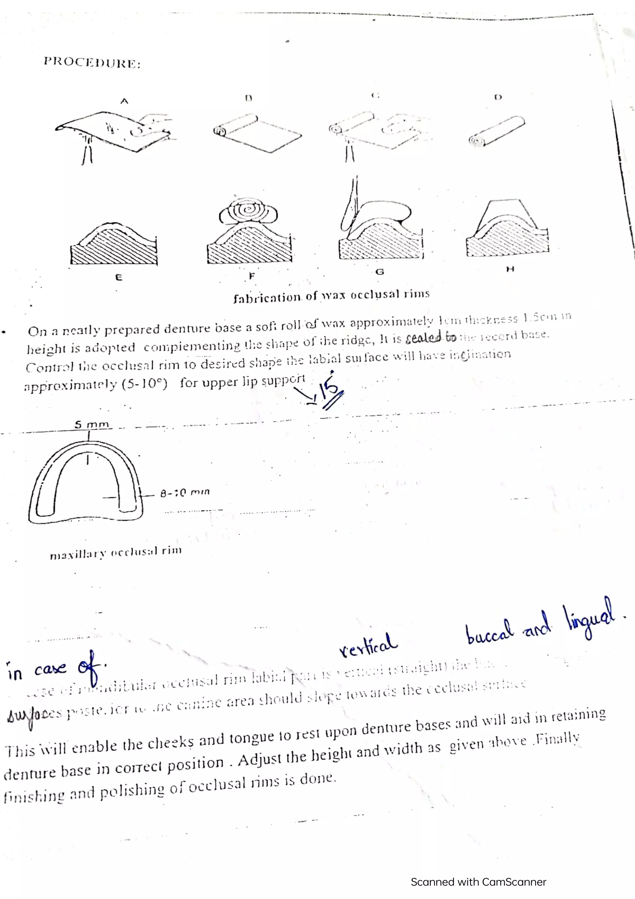 denture base and occlusal rim notes.pdf