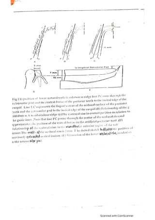 denture base and occlusal rim notes.pdf