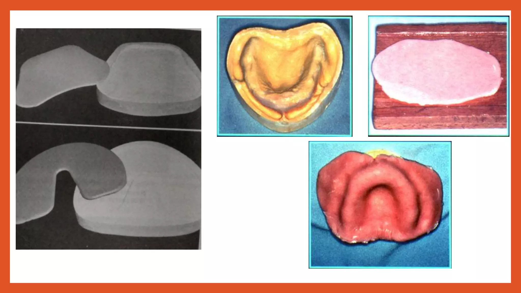 Denture base and occlusal rims | PPTX