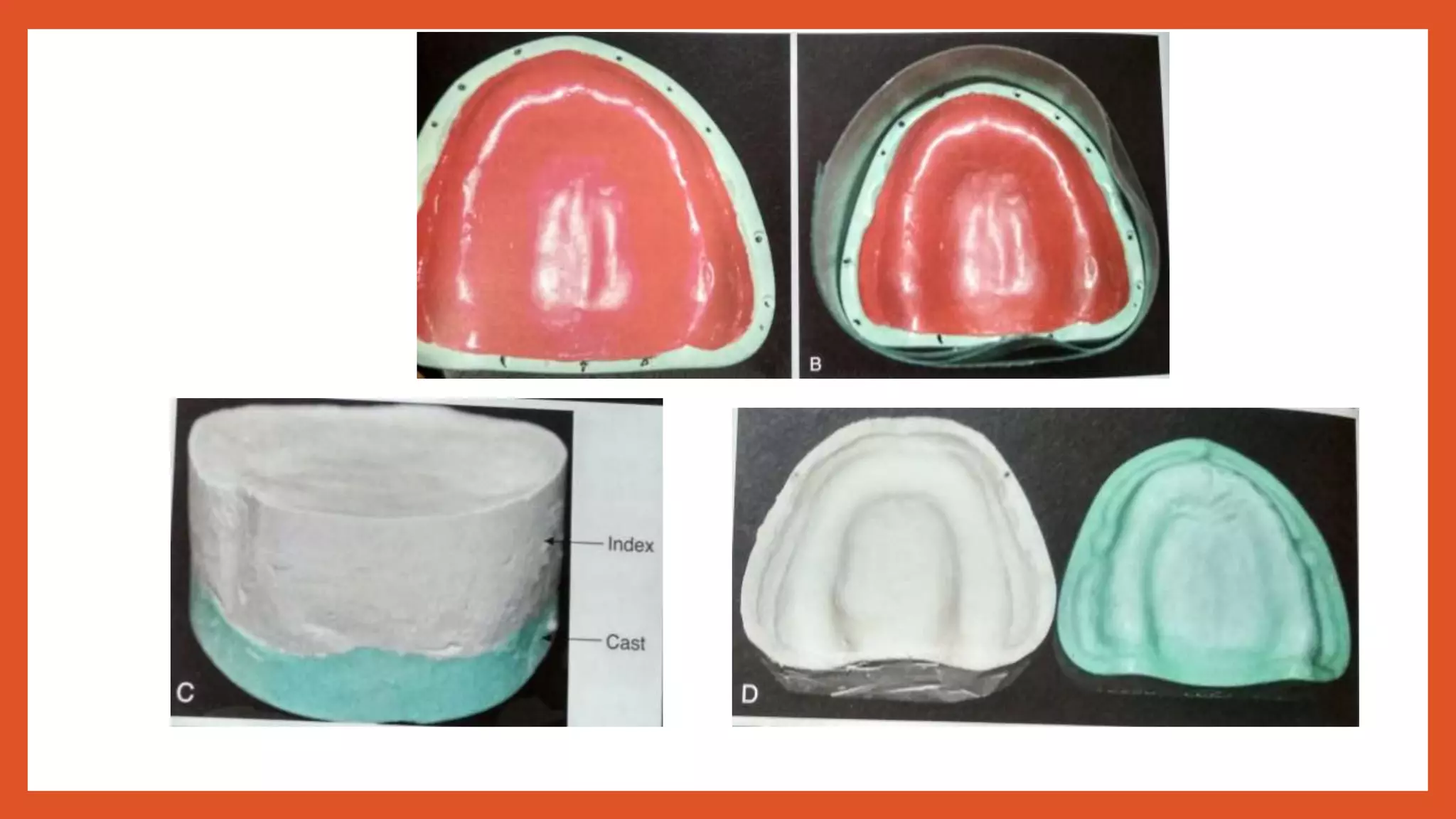 Denture base and occlusal rims | PPTX